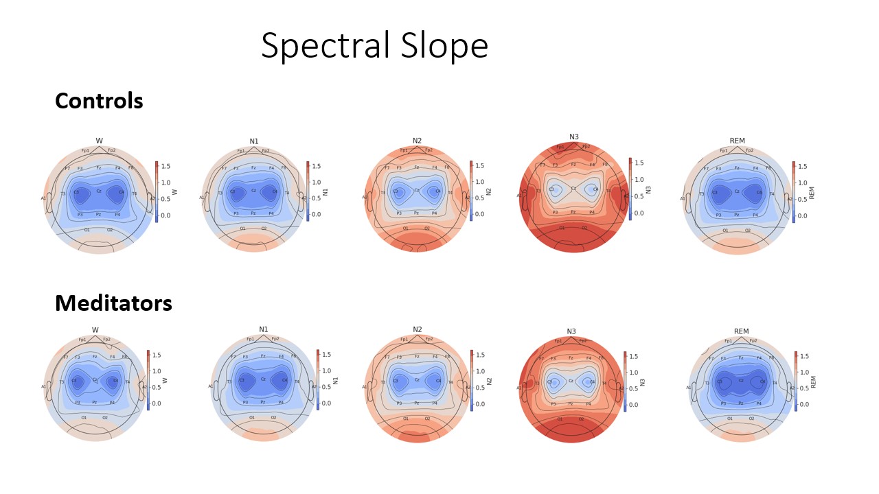 Results — Sleep EEG: FOOOF Analysis