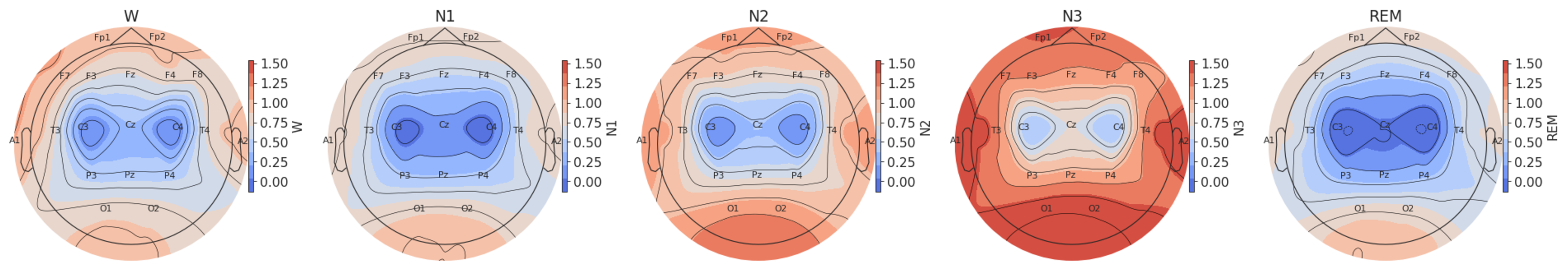 Results — Sleep EEG: FOOOF Analysis